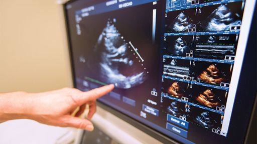 Advances in Cardiologic Assessment For Oncology Patients | Englewood Health